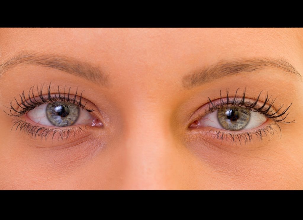 What Is Macular Degeneration How Does It Affect Eyes And Who Are In 